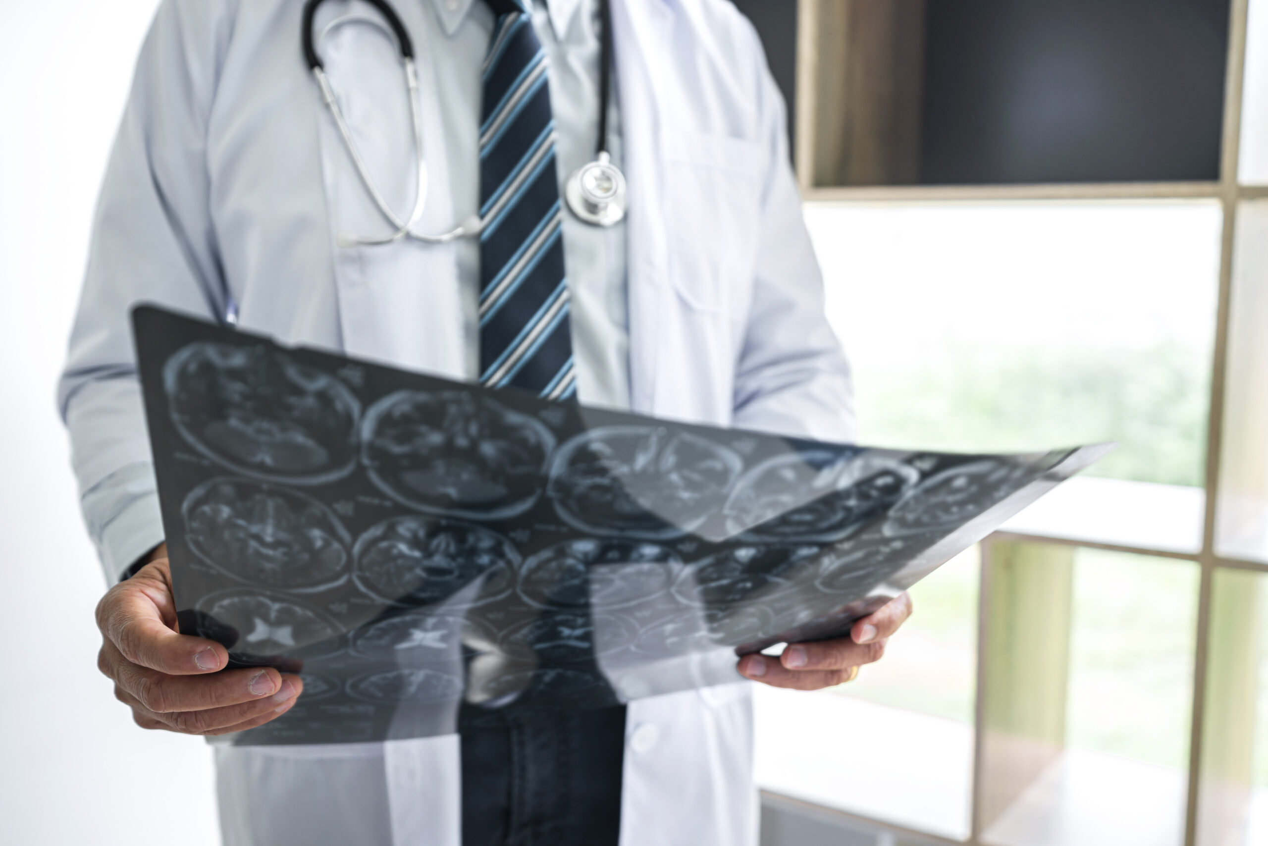 Demystifying Strokes: Separating Fact from Fiction - Crisp Regional Demystifying Strokes: Separating Fact from Fiction - Crisp Regional